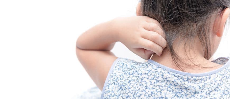 Cómo identificar ronchas provocadas por alergias alimentarias | Blog ...